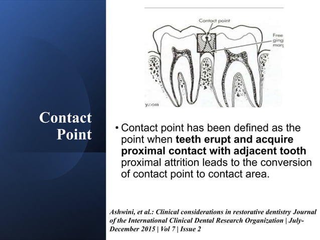 CONTACTS AND CONTOURS IN DENTISTRY | PPTX | Dental Health | Diseases ...