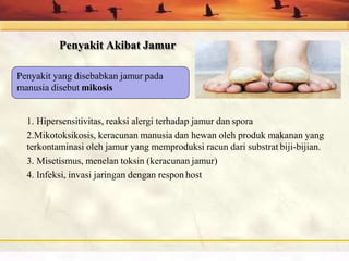 Ppt agen infeksius Jamur Ilmu Kep Dasar kes | PPTX