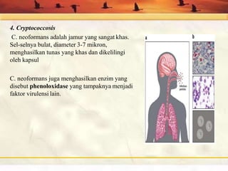 Ppt agen infeksius Jamur Ilmu Kep Dasar kes | PPTX