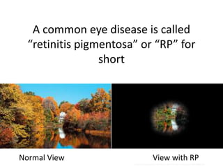 Diseases Of The Eye | PPT