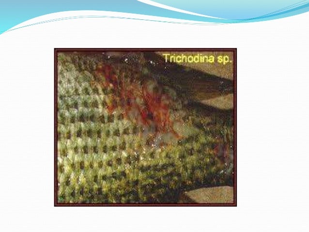 Trichodiniasis