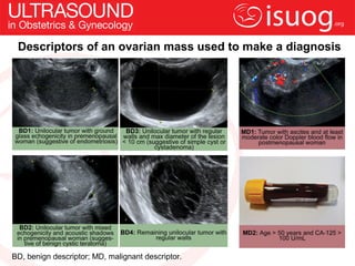 UOG Journal Club: Improving strategies for diagnosing ovarian cancer: a ...