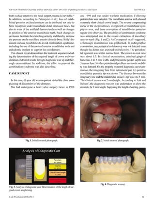 full mouth rehabilitation of partially and fully edentulous patient ...