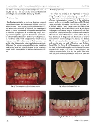 full mouth rehabilitation of partially and fully edentulous patient ...