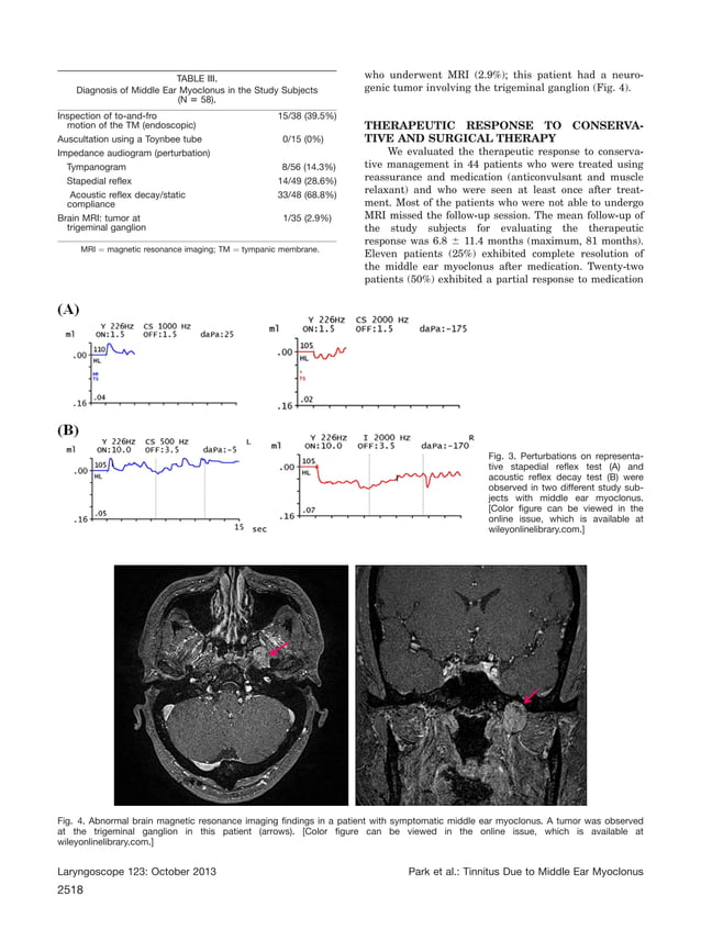 Middle ear myoclonus | PDF