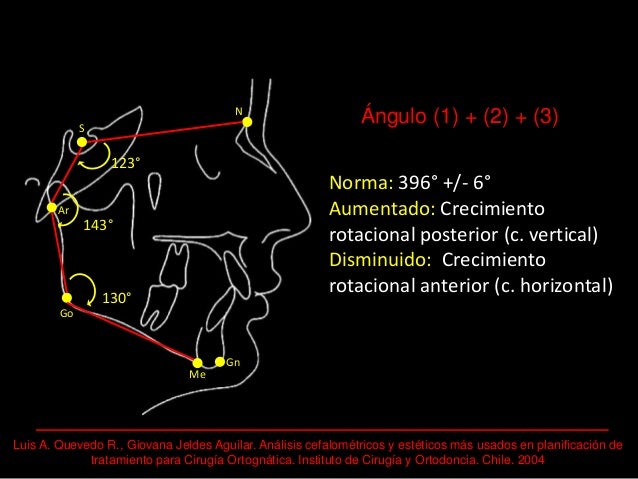 cefalometria de jarabak