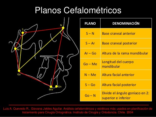 cefalometria de jarabak