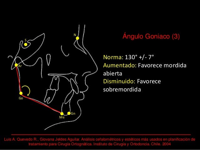 cefalometria de jarabak