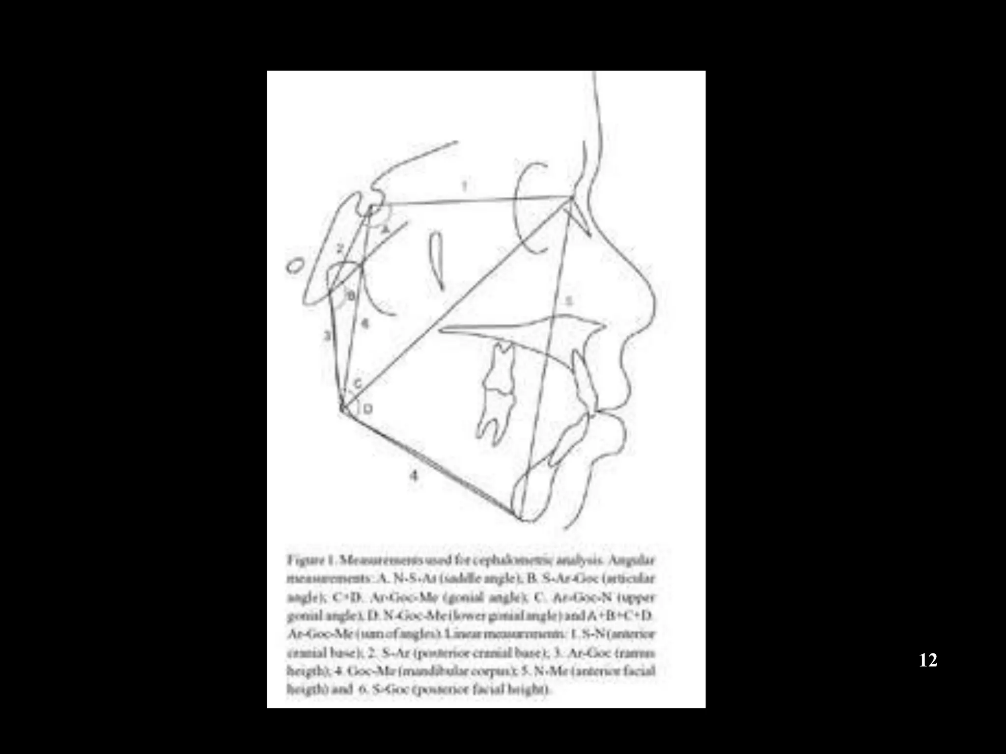 Jarabak cephalometric analysis | PPTX