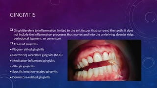 gingival diseases of periodontium 1.pptx