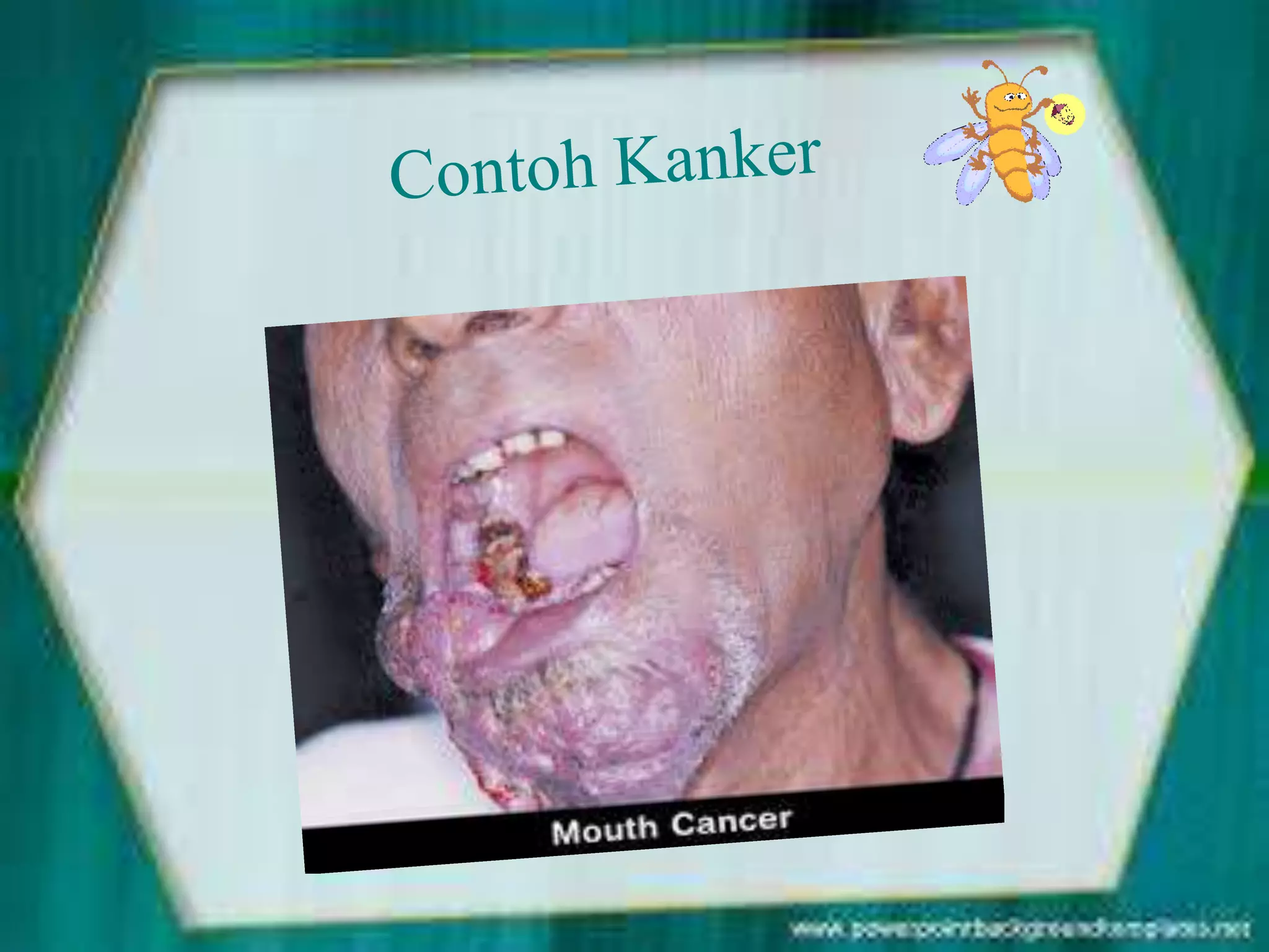 Jaringan hewan x ci dwi ditha-fidia-syafira-virga | PPT