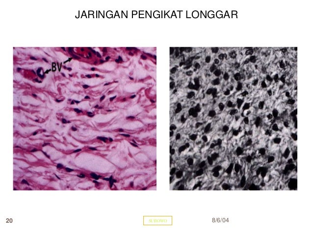 Jaringan ikat (modul kulit dan jaringan penunjang)