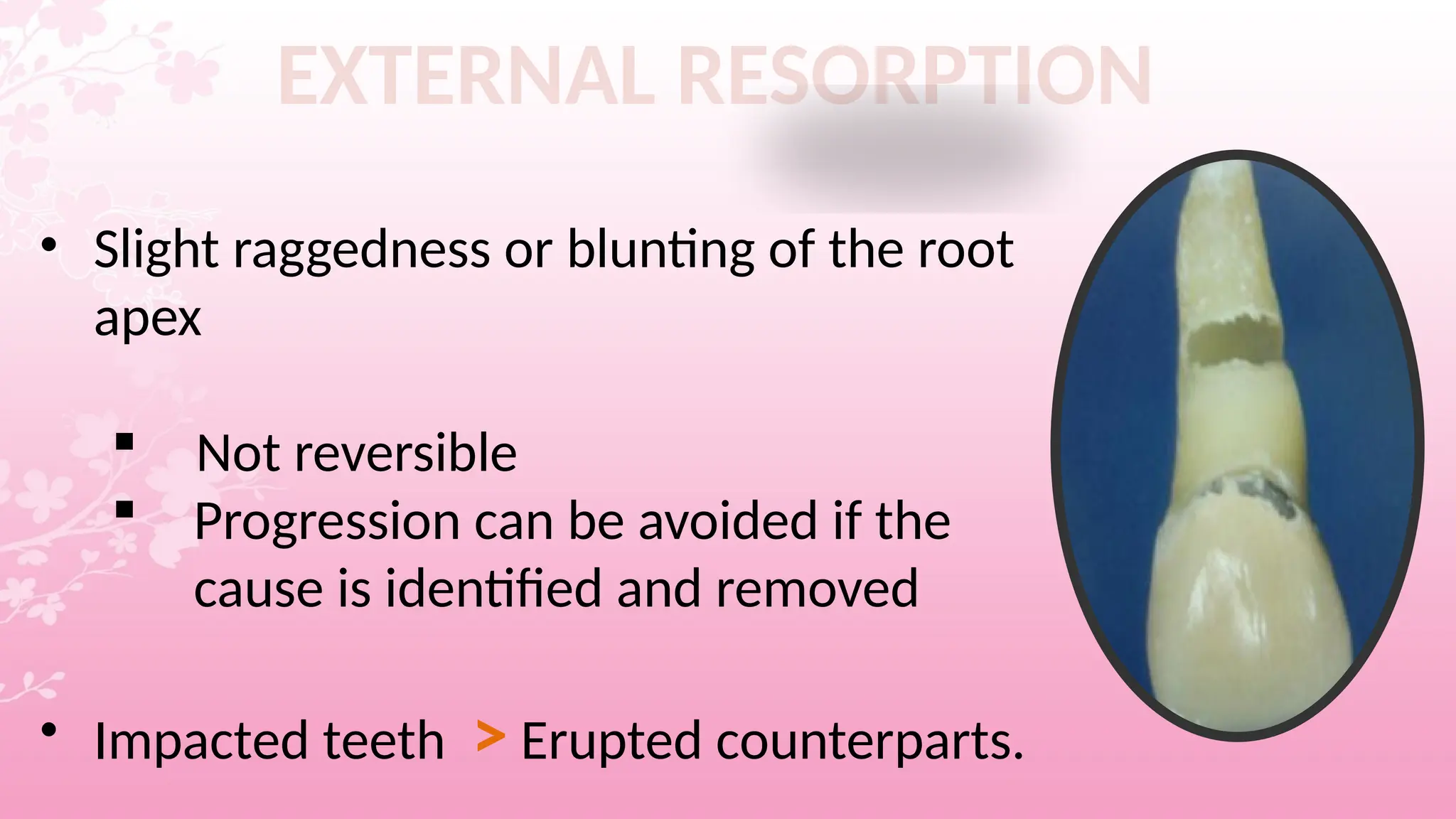 pink tooth.pptx BDS PEDODONTICS J .K .K N | PPTX