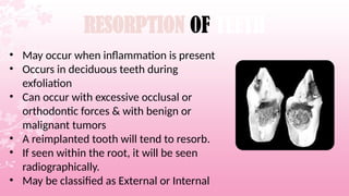 pink tooth.pptx BDS PEDODONTICS J .K .K N | PPTX