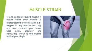 5 types of physical injuries. pathfit pptx | PPTX