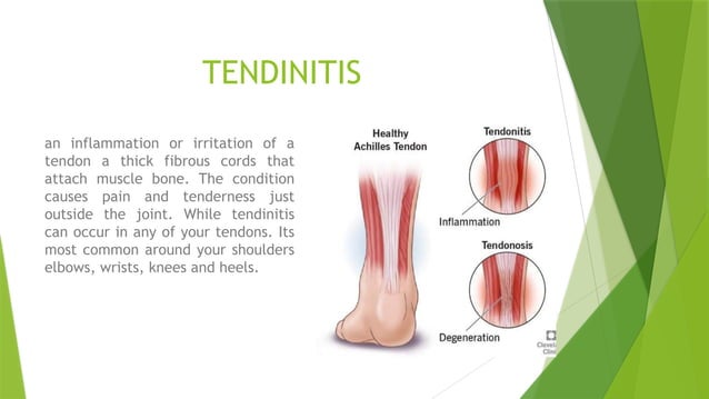 5 types of physical injuries. pathfit pptx | PPTX