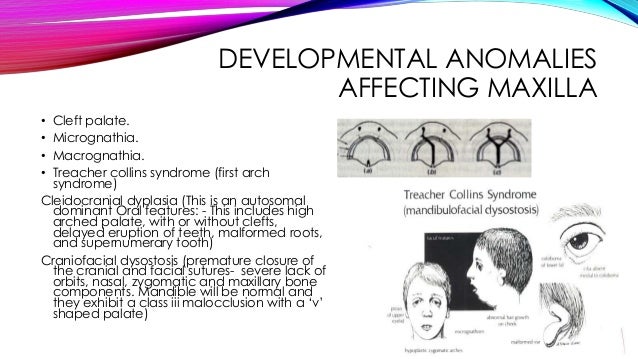 growth and development of maxilla