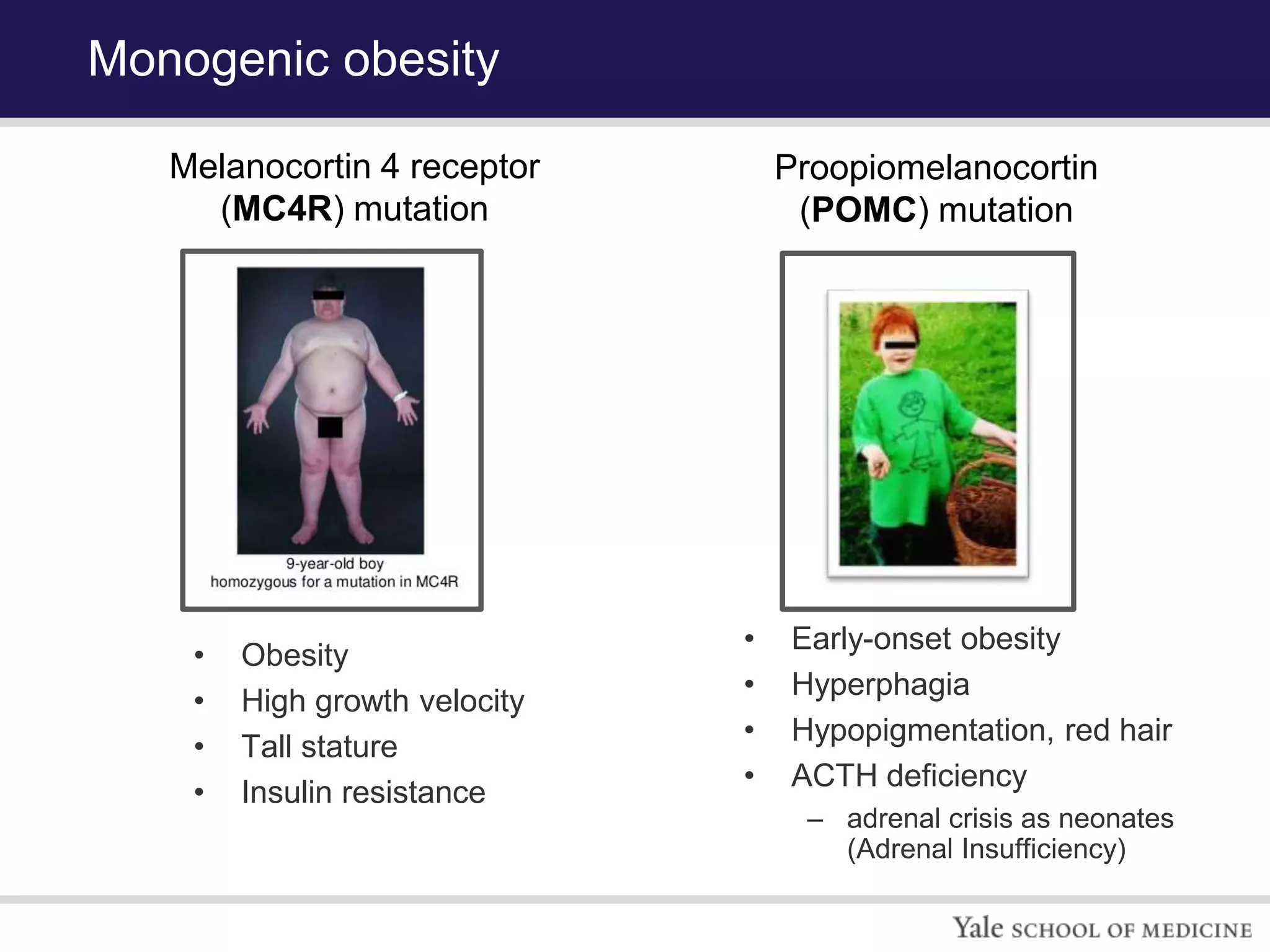 Anti-Obesity Pharmacotherapy: Where are we now? Where are we going? | PPTX