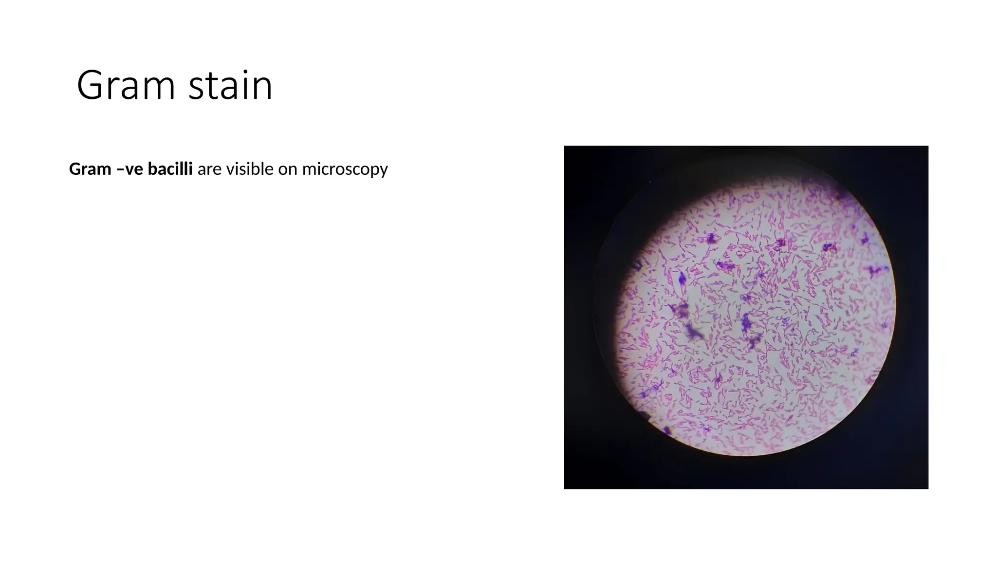 microbiology presentation on amr surveillance | PPTX