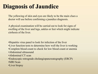 Jaundice | PPTX