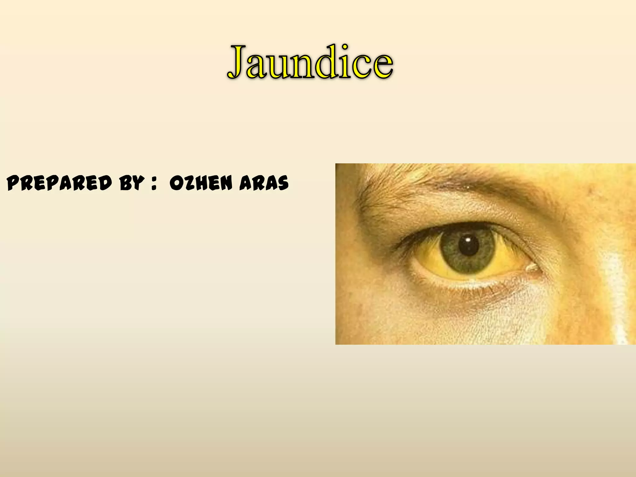 All about Jaundice | PPTX