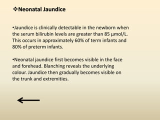 All about Jaundice | PPTX