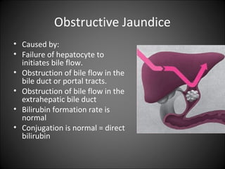 Jaundice | PPT