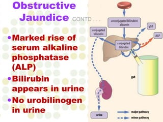 Dark Urine Jaundice
