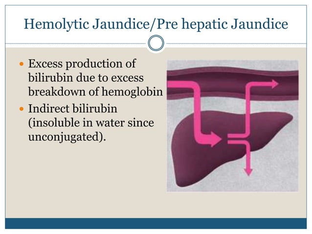 Jaundice | PPTX | Blood Disorders | Diseases and Conditions