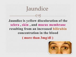 jaundice-160414200805.pptx