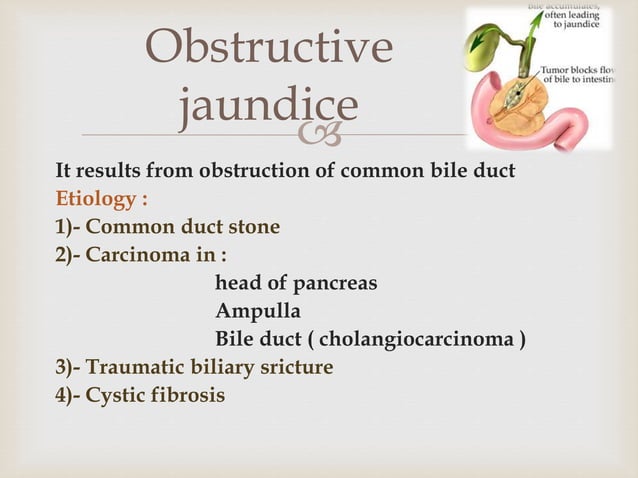 jaundice-(three types)- pre hepatic, hepatic , post hepatic | PDF ...
