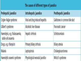 jaundice-(three types)- pre hepatic, hepatic , post hepatic | PDF