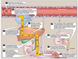 jaundice-(three types)- pre hepatic, hepatic , post hepatic | PDF