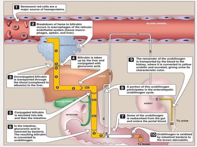 jaundice-(three types)- pre hepatic, hepatic , post hepatic | PDF ...