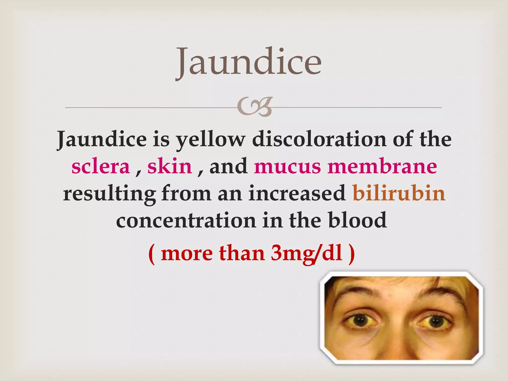 Jaundice | PPTX