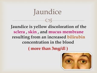 Jaundice | PPTX