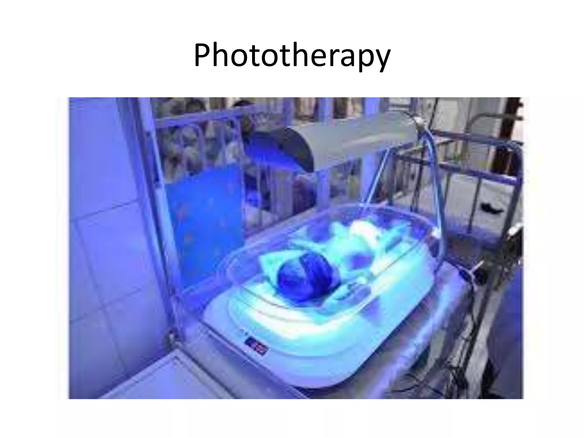 Neonatal Jaundice- Dr. Karuppiah Pandi- Pediatrics- MGMCRI | PPTX
