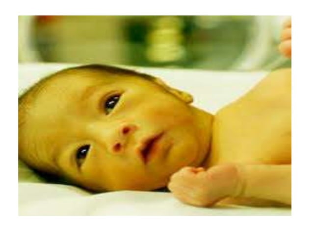 Neonatal Jaundice- Dr. Karuppiah Pandi- Pediatrics- MGMCRI | PPT