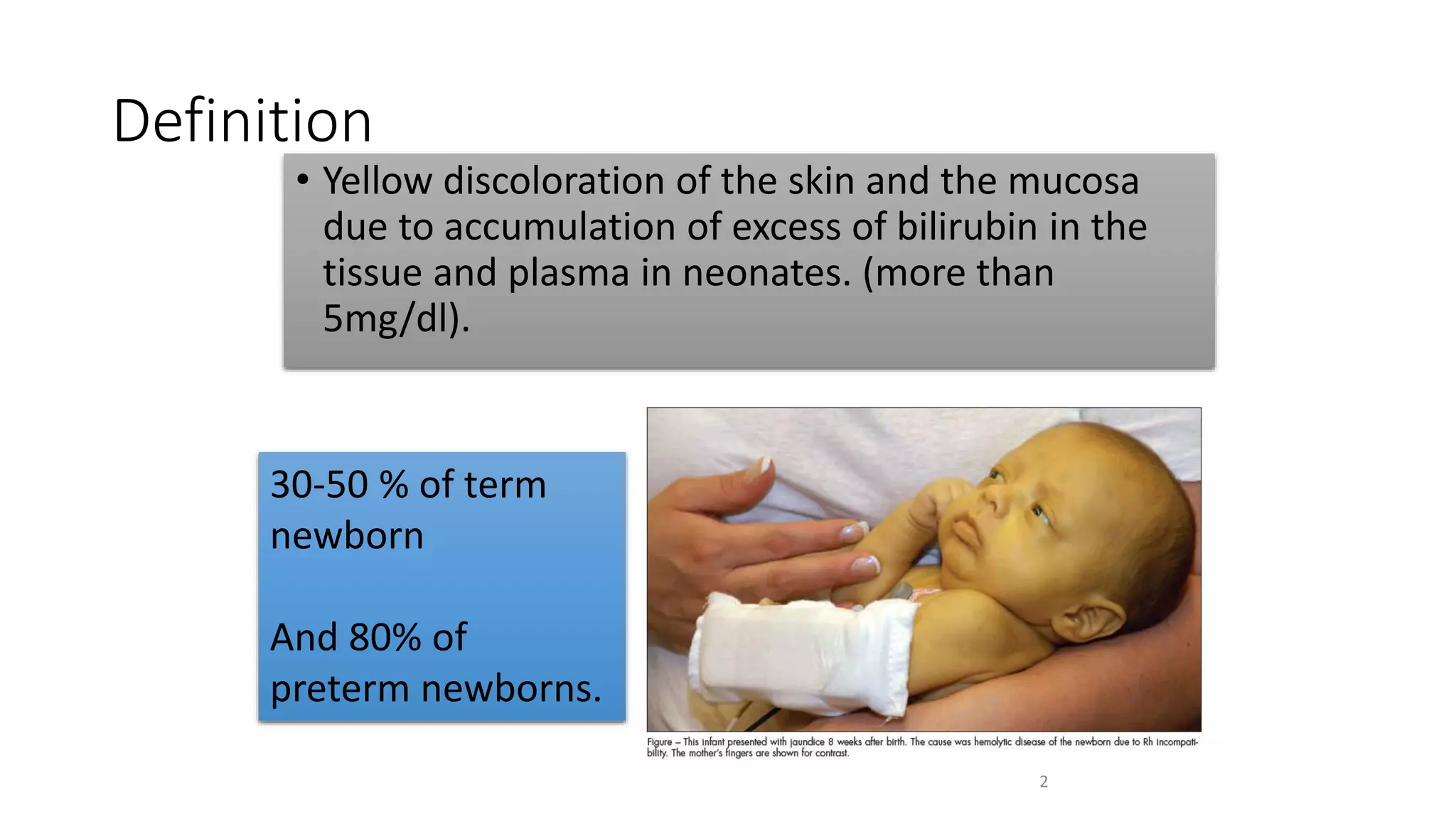 neonatal Jaundice | PPTX