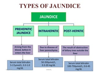 Jaundice | PPTX