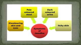 Jaundice | PPTX