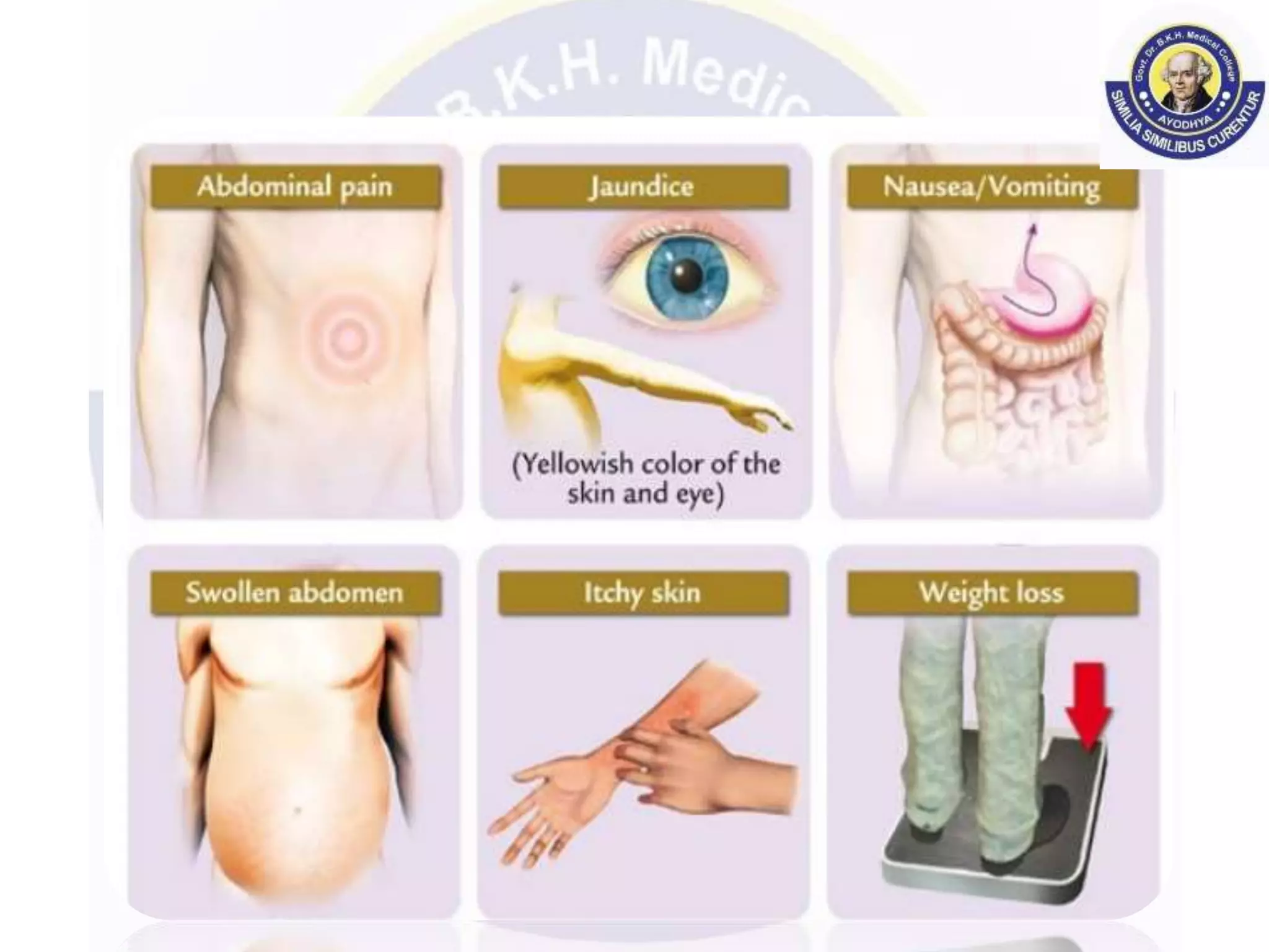 Jaundice Pathology | PPTX