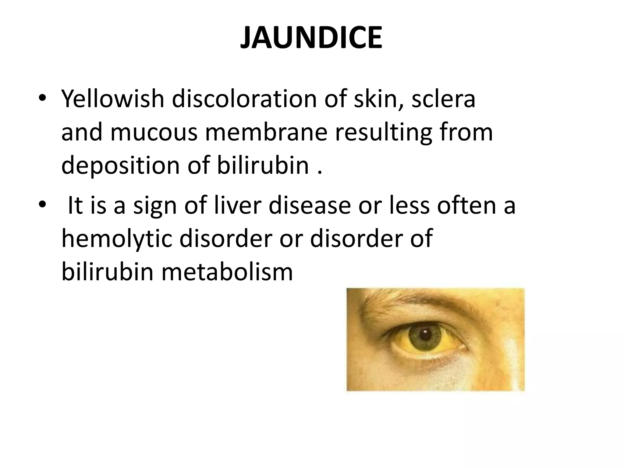 Jaundice | PPTX