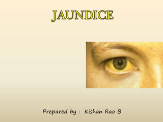 Jaundice.pptx