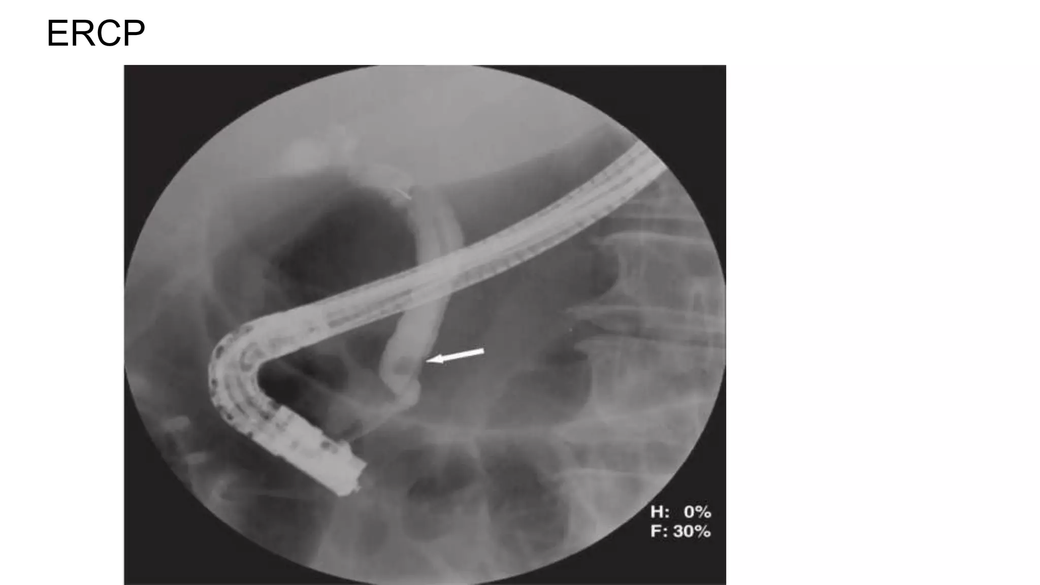 Surgical implications in Jaundice.pptx | Free Download