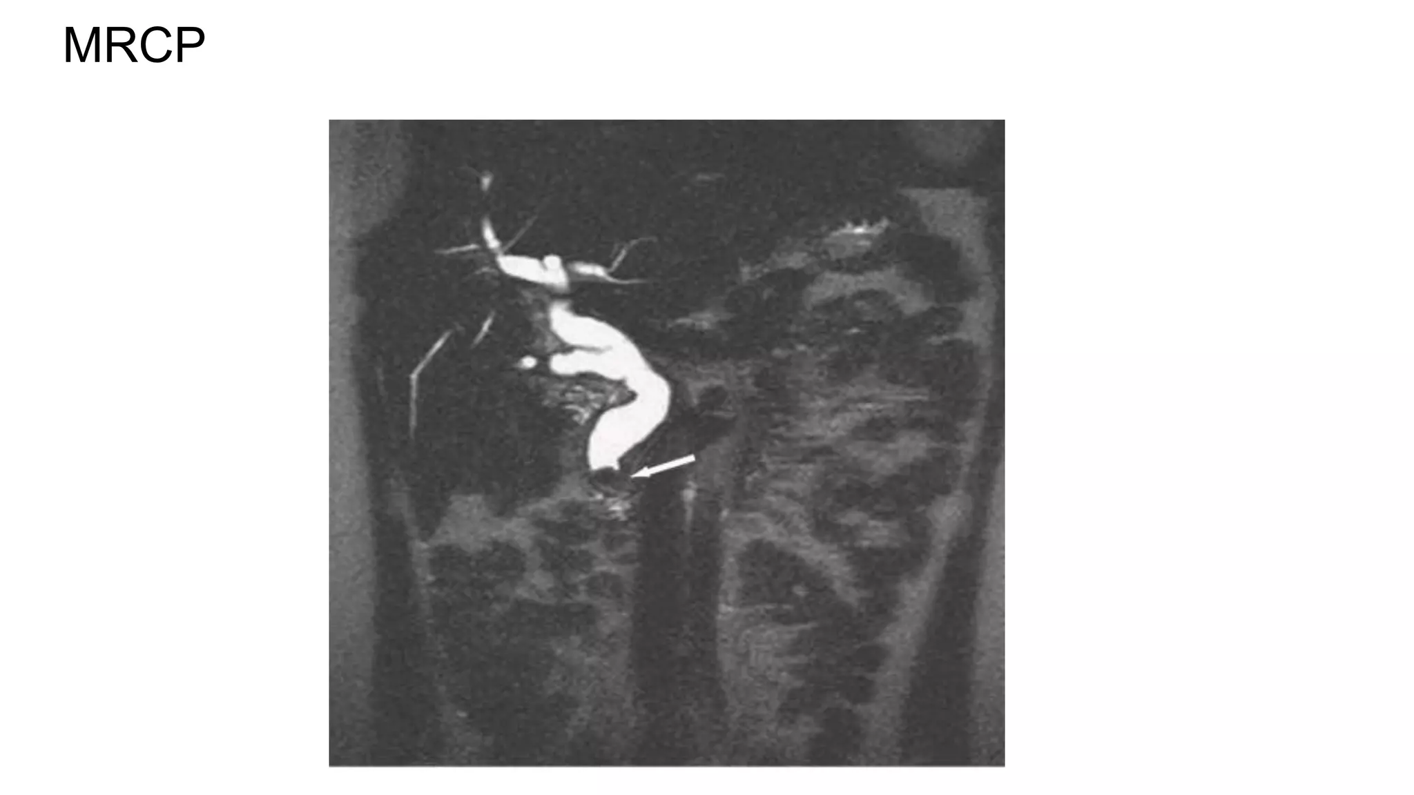 Surgical implications in Jaundice.pptx | Free Download