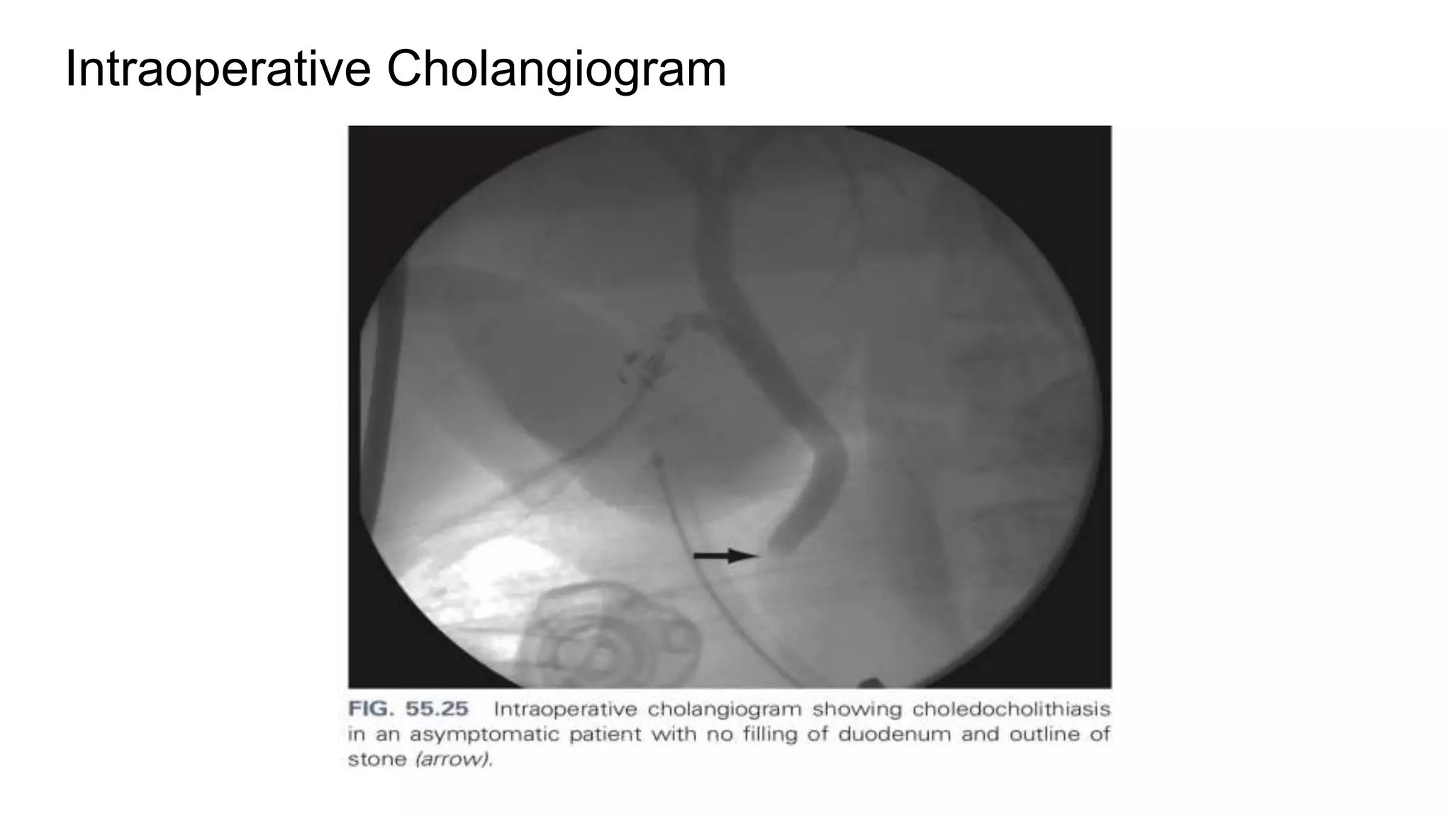 Surgical implications in Jaundice.pptx | Free Download