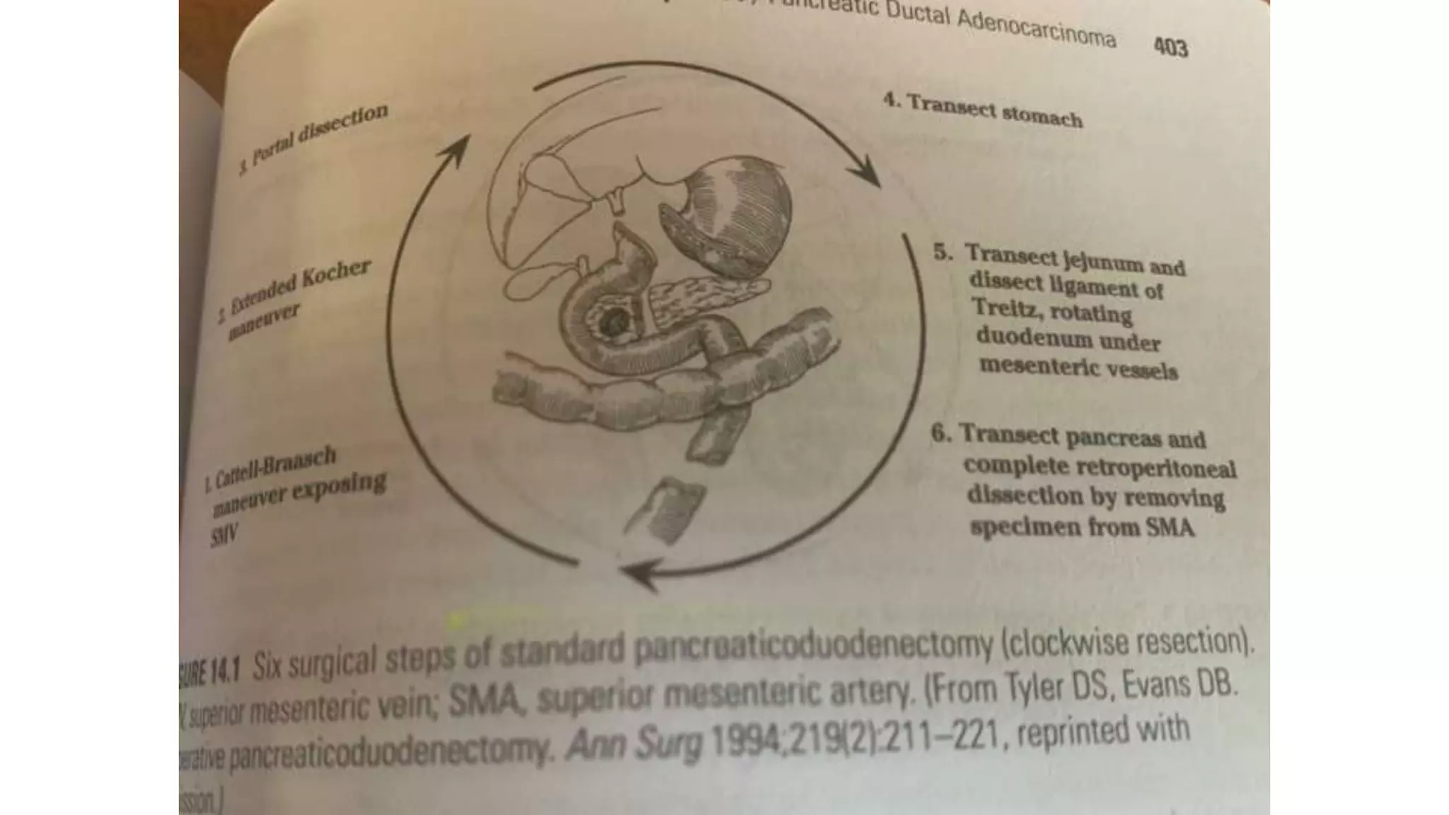 Surgical implications in Jaundice.pptx | Free Download