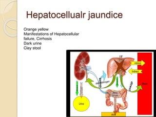 Jaundice | PPT