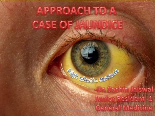 Approach to a case of Jaundice. | PPTX